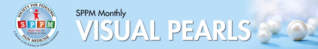 SPPM Visual Pearls - Society for Pediatric Pain Medicine